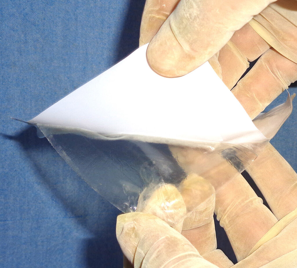 Helicoll® is ideal for tissue regeneration and safe for patients of all ...